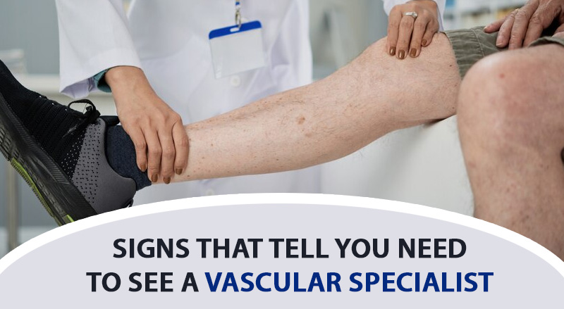 Signs that Tell You Need to See a Vascular Specialist